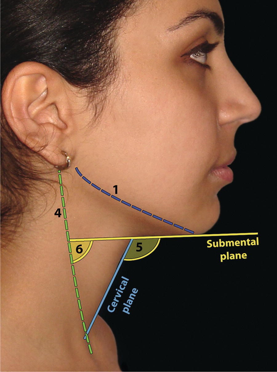 Submental‐Cervical Region | Plastic Surgery Key