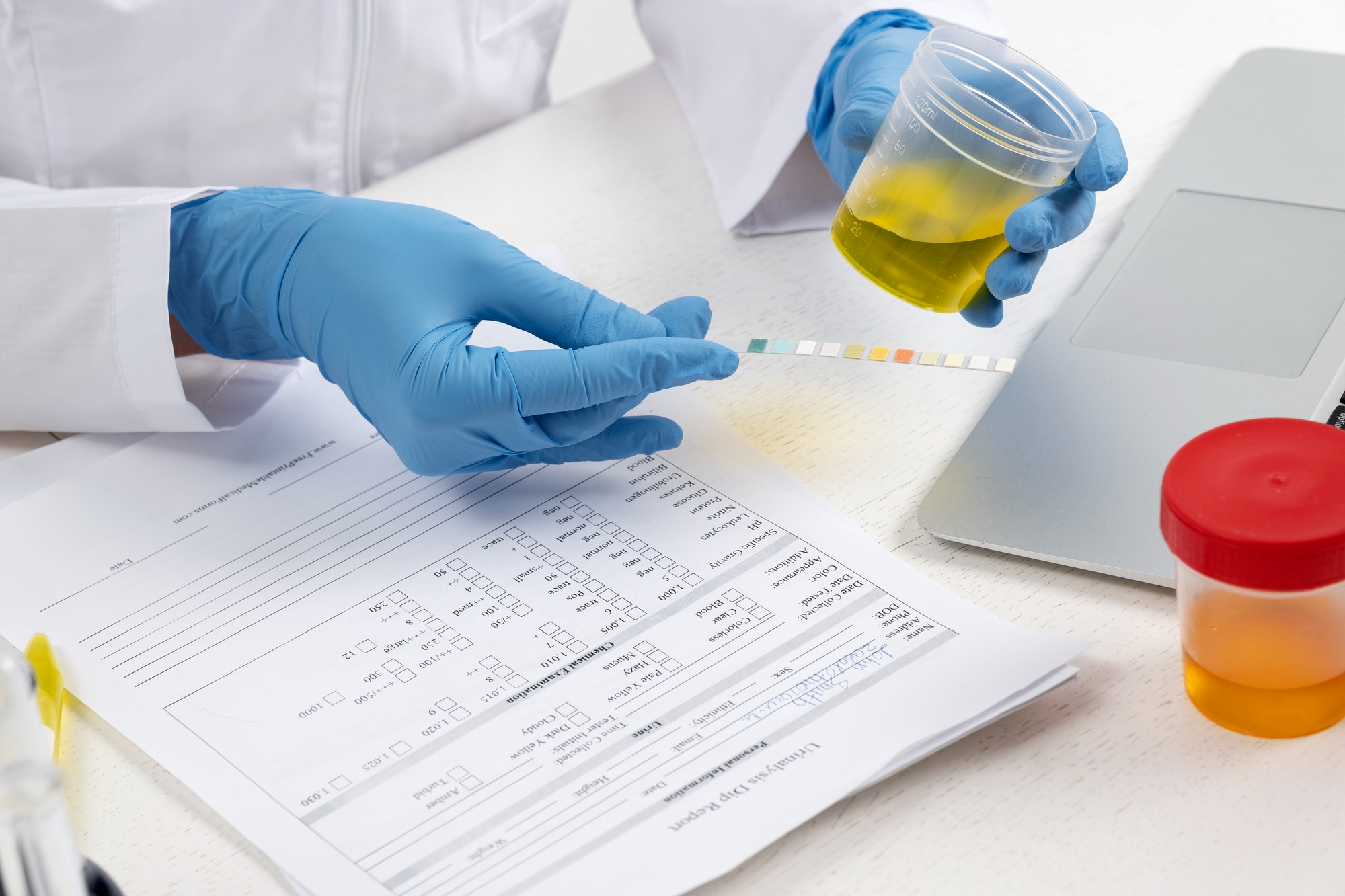 Best Synthetic Urine to Buy in 2026: Lab-Tested Reviews & Buyer Guide ...